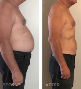 Skinny Drops | Slenderiiz Drops & Xceler8 Support Weight Loss